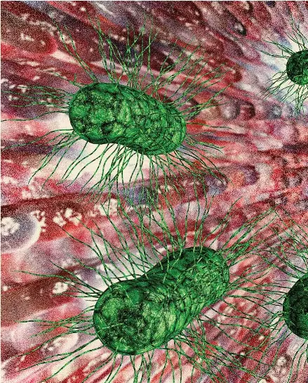 SIBO: EL RIESGO DE AUTODIAGNO­STICARSE EL TRASTORNO DE MODA - PressReader