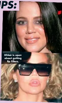 EXPLODING LIPS: HOLLYWOOD’S LATEST SURGERY TREND - PressReader