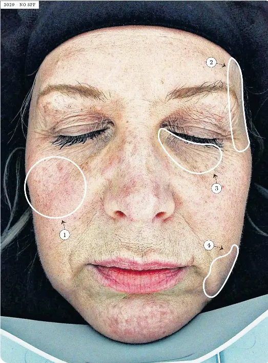 This is what I will look like in five years’ time if I stop using sun ...