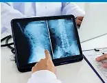 DeepTek introduces AI powered lumbar spine quantifica­tion automation ...