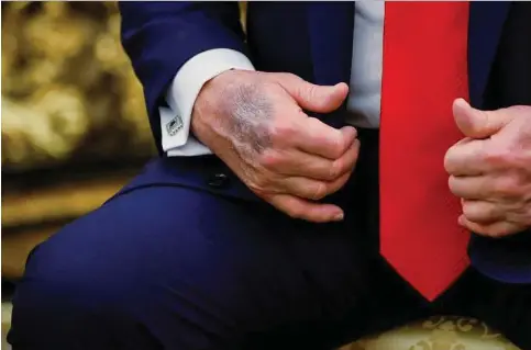 Hvad foregår der med Trumps helbred? - PressReader