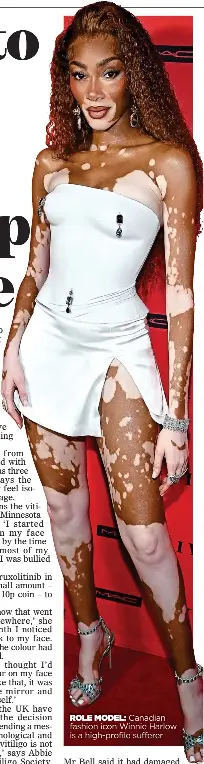 NHS refuses to fund drug for skin problem that affects top model Winnie - PressReader