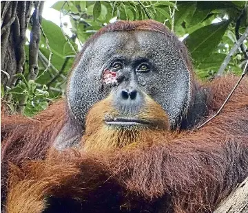 Wound treatment observed - PressReader