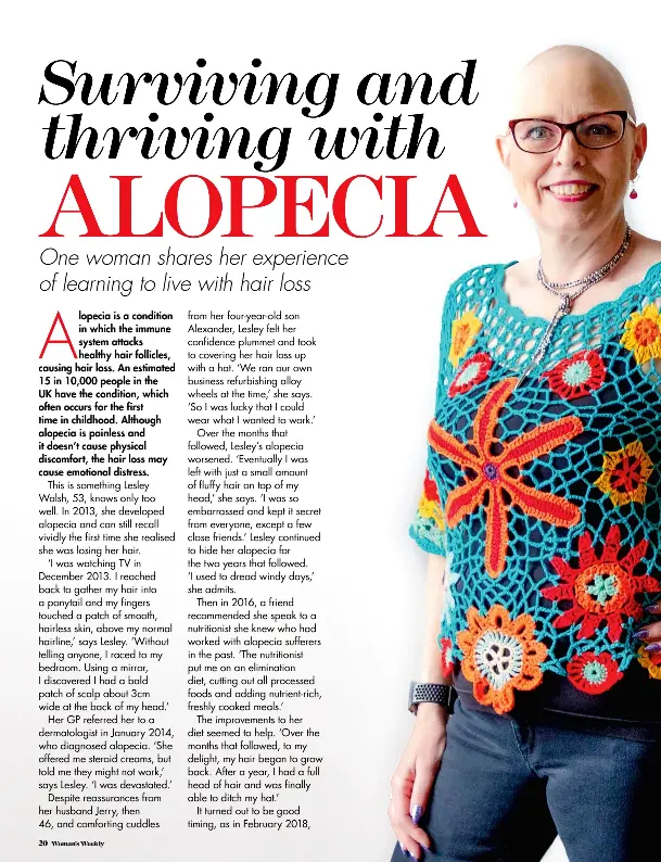 Surviving and thriving with alopecia - PressReader