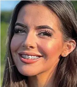 Why do the guys I date have such a weird fascinatio­n with my braces ...