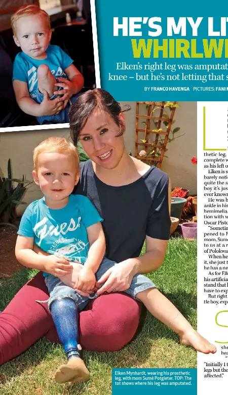 My boy’s a one-legged wonder - PressReader