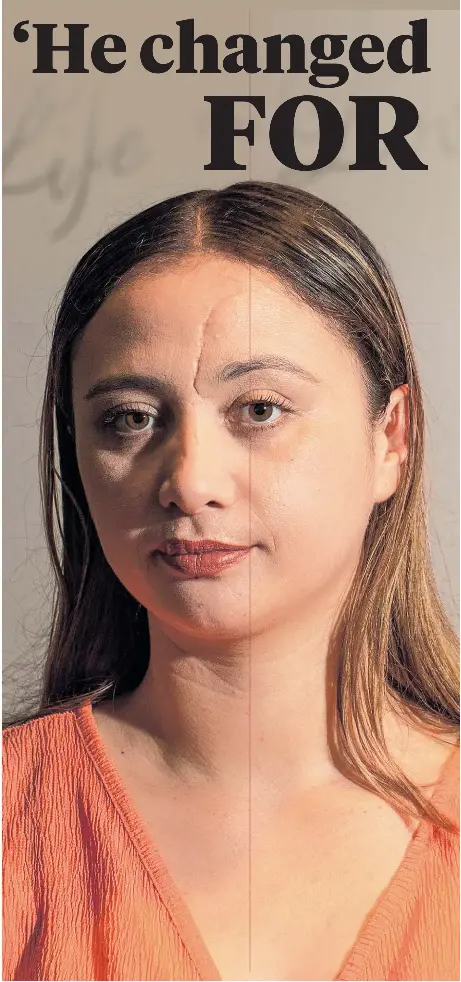 Mum disfigured by ex is livid he released music two days after finishing home detention ...