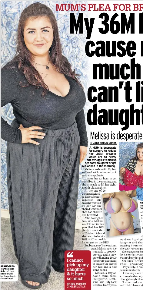 My 36M boobs cause me so much pain I can’t lift my daughter up ...