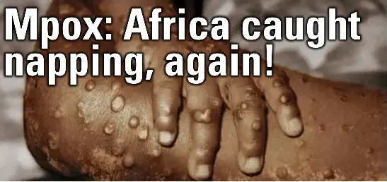 Mpox: Africa caught napping, again! - PressReader