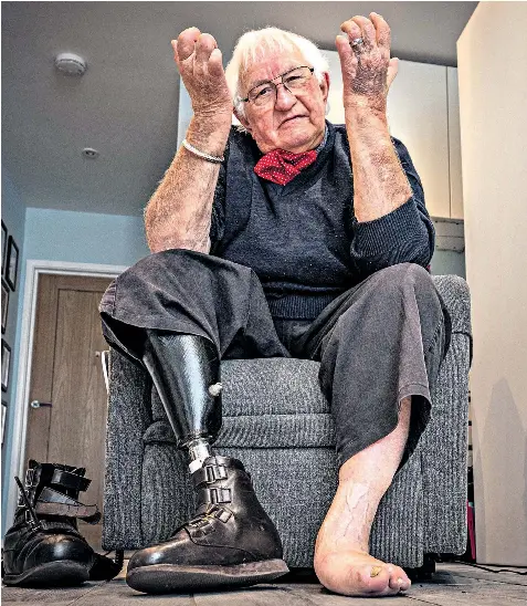 Meet the Somerset ‘lepers’ fighting stigma from the West Country ...