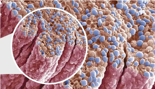 Gatekeepin­g iris colours your eyes - PressReader