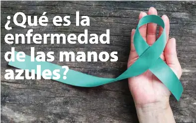 ¿Qué es la enfermedad de las manos azules? - PressReader
