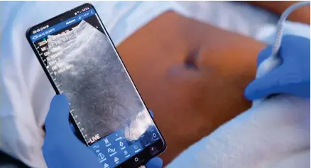 Osaat Africa launches handheld sonar probe - PressReader