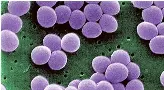New physics-based model shows healthy guts resist microbial chaos ...