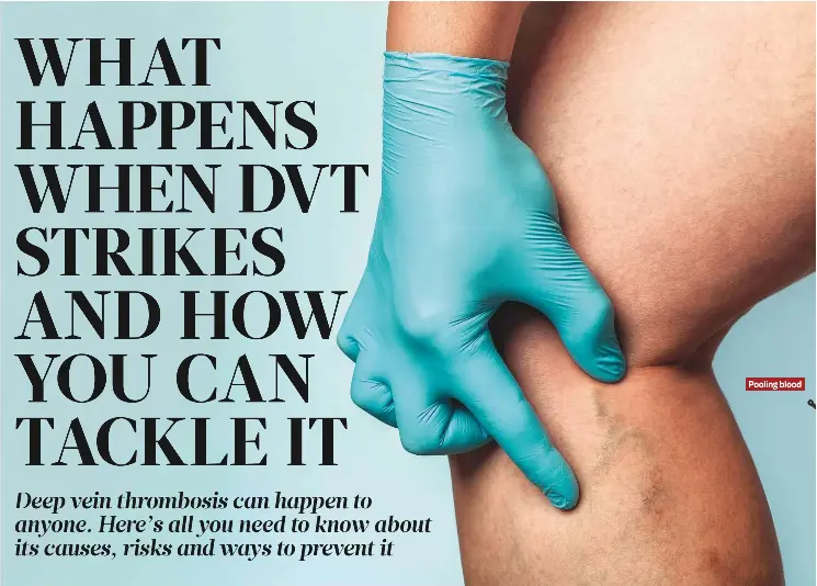 WHAT HAPPENS WHEN DVT STRIKES AND HOW YOU CAN TACKLE IT - PressReader