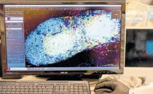 Autoimmune treatments struggle, prompting new approach - PressReader