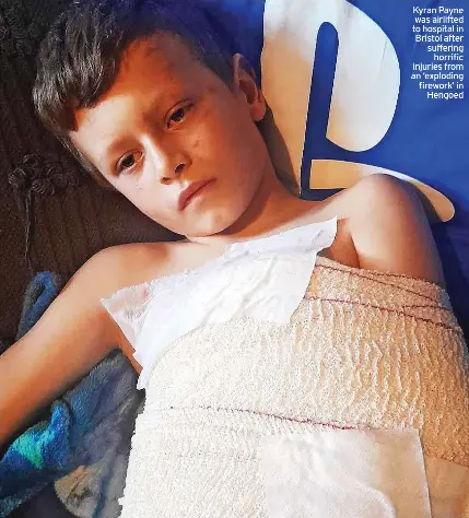 Fireworks warning from mum after boy lost fingers - PressReader