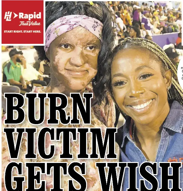 BURN VICTIM GETS WISH - PressReader