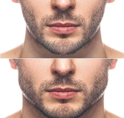 What is mewing? - PressReader