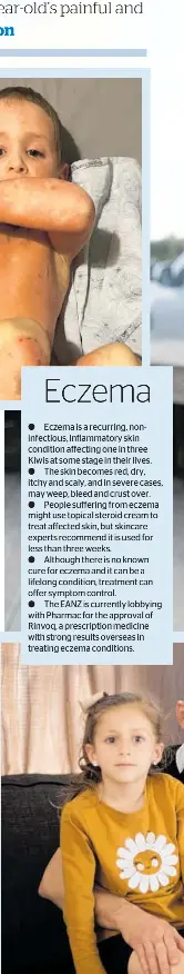 The boy whose skin is ‘on fire’ - PressReader