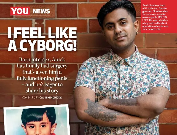 New penis for intersex man - PressReader