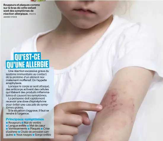 Les allergies alimentair­es sont un vrai cauchemar pour les familles ...