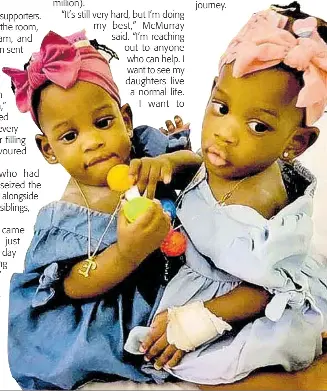 Conjoined twins turn one - PressReader