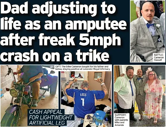 Dad adjusting to life as an amputee after freak 5mph crash on a trike ...