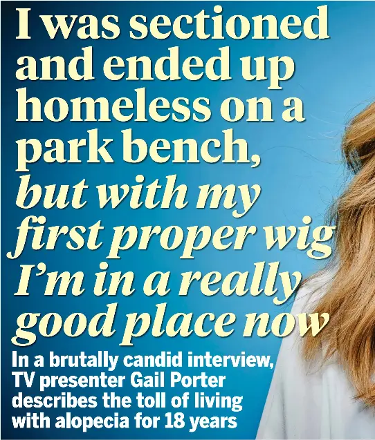 I was sectioned and ended up homeless on a park bench, but with my first proper wig I’m in a ...