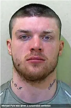 Man broke partner’s nose in violent attack - PressReader