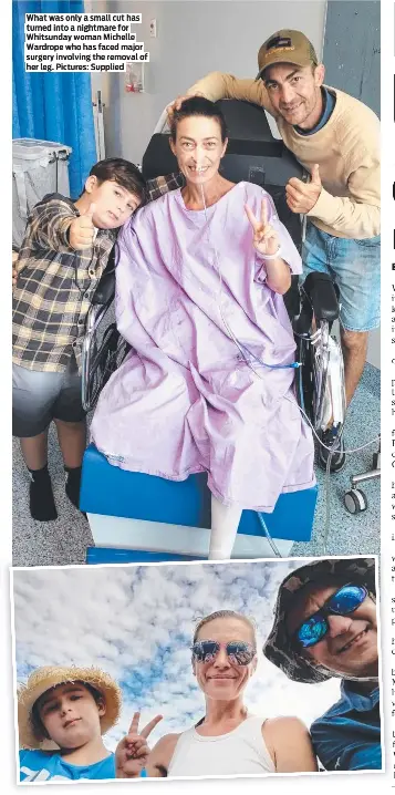 Mother loses leg after cut - PressReader