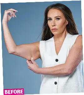 I spent £8,500 on an arm lift ...and now I’m going sleeveless for the ...