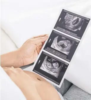 Should I go ahead with shock pregnancy aged 45? I’m very confused - PressReader