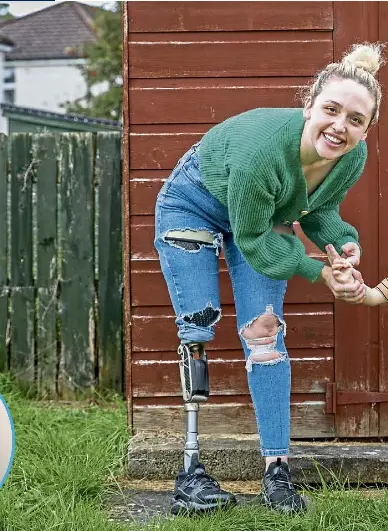 Dundee mum: I lost leg but won my cancer fight - PressReader