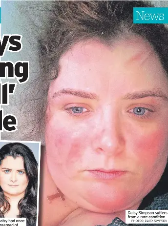 Dying Daisy says council is ‘putting her through hell’ in housing ...