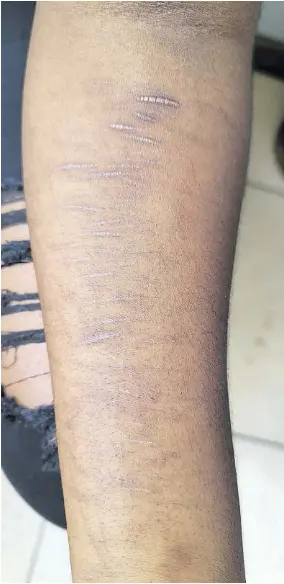 Alarming growth in self-injury cases - PressReader