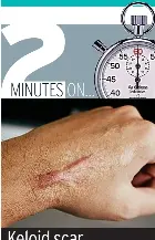 Keloid scar - PressReader
