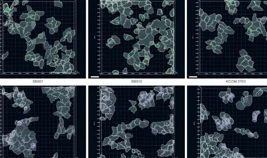 A mouth bacteria has starring role in colorectal cancer: study ...