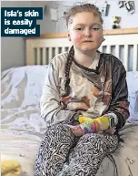 Isla Grist Teenager of courage - PressReader