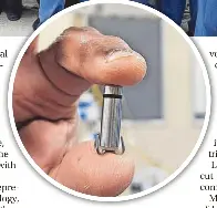 New pacemaker technology fitted for first time in region - PressReader