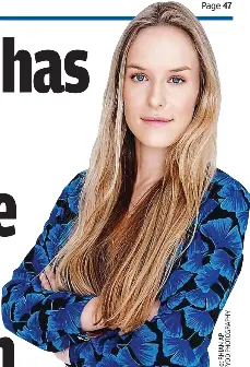 How epilepsy has left a society beauty unable to remember anything from ...