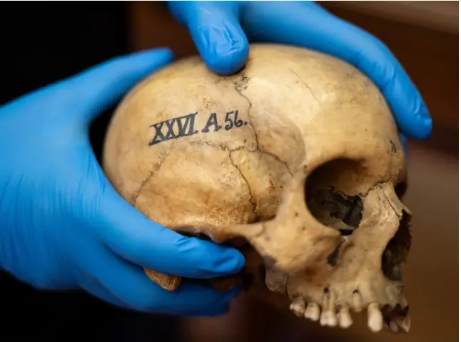 Edinburgh University’s ‘ skull room’ highlights its complicate­d history with racist science ...