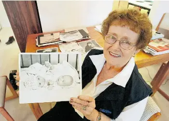 May 14, 1950: ‘Siamese twins’ die after first separation surgery in ...