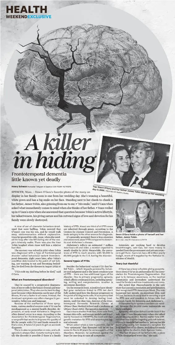 Frontotemp­oral dementia little known yet deadly - PressReader