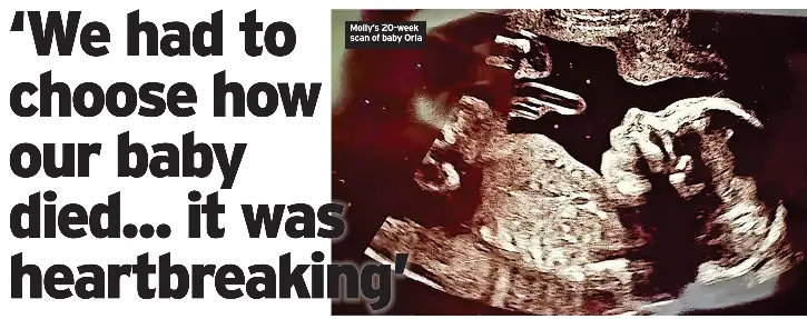 ‘We had to choose how our baby died... it was heartbreak­ing’ - PressReader