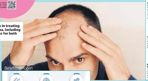 Dr Batra’s® introduces XOGEN, an advanced hair regenerati­on treatment in India How Xogen works ...