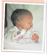 What is Edwards’ syndrome? - PressReader