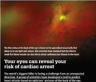 Your eyes can reveal your risk of cardiac arrest - PressReader