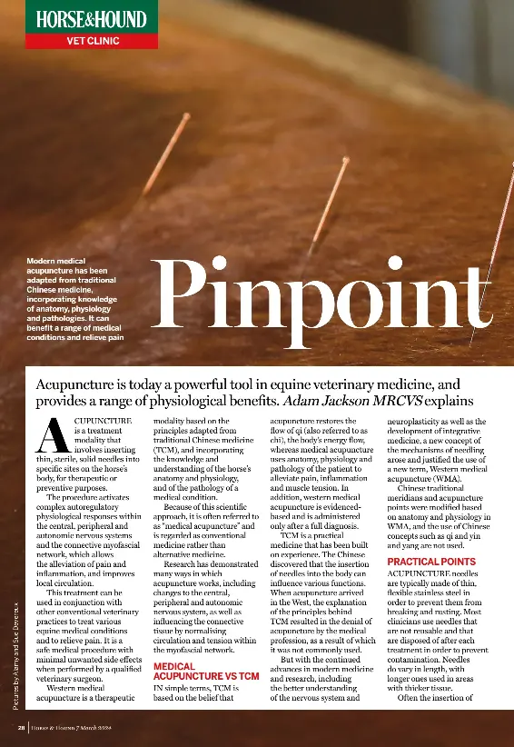 MEDICAL ACUPUNCTUR­E VS TCM Pinpoint pressure - PressReader