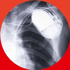 The Pacemaker - PressReader